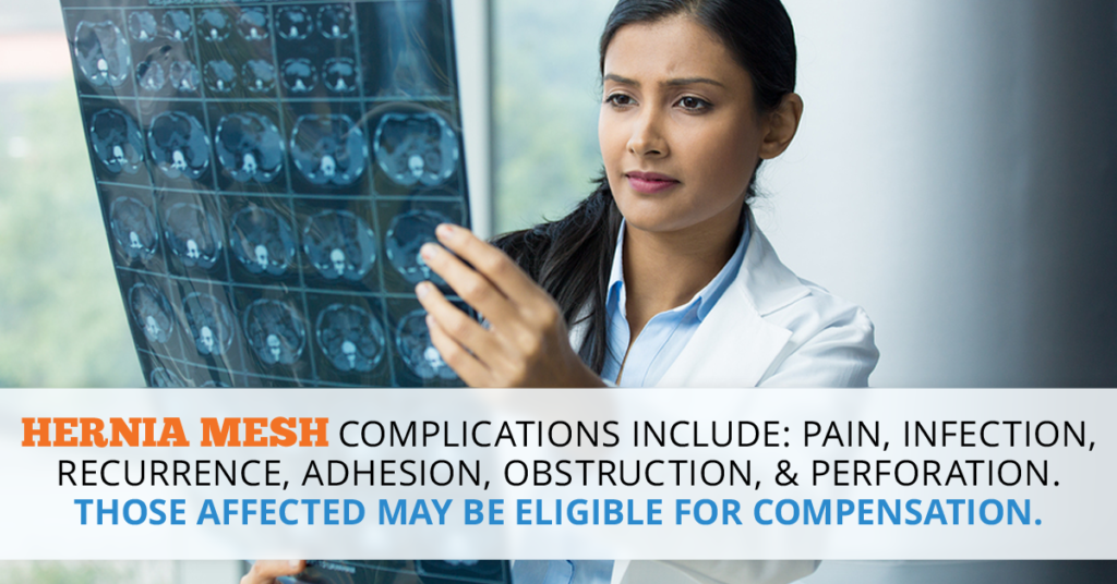 Hernia Mesh Safety & Complications // Consumer Safety Watch - Consumer ...