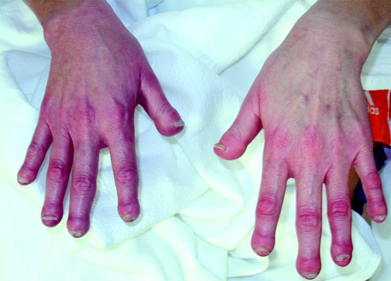 gadolinium-toxicity - Consumer Safety Watch